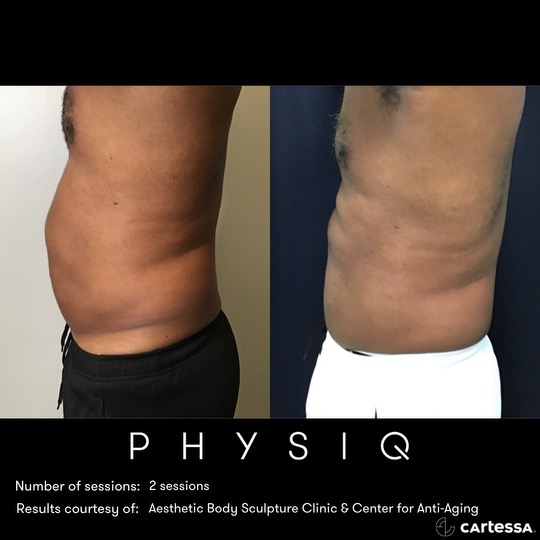 PHYSIQ 360 - Men's Contemporary Health Center