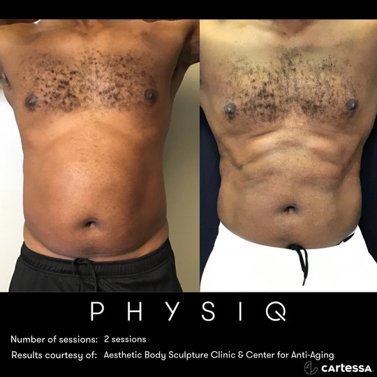 PHYSIQ 360 - Men's Contemporary Health Center