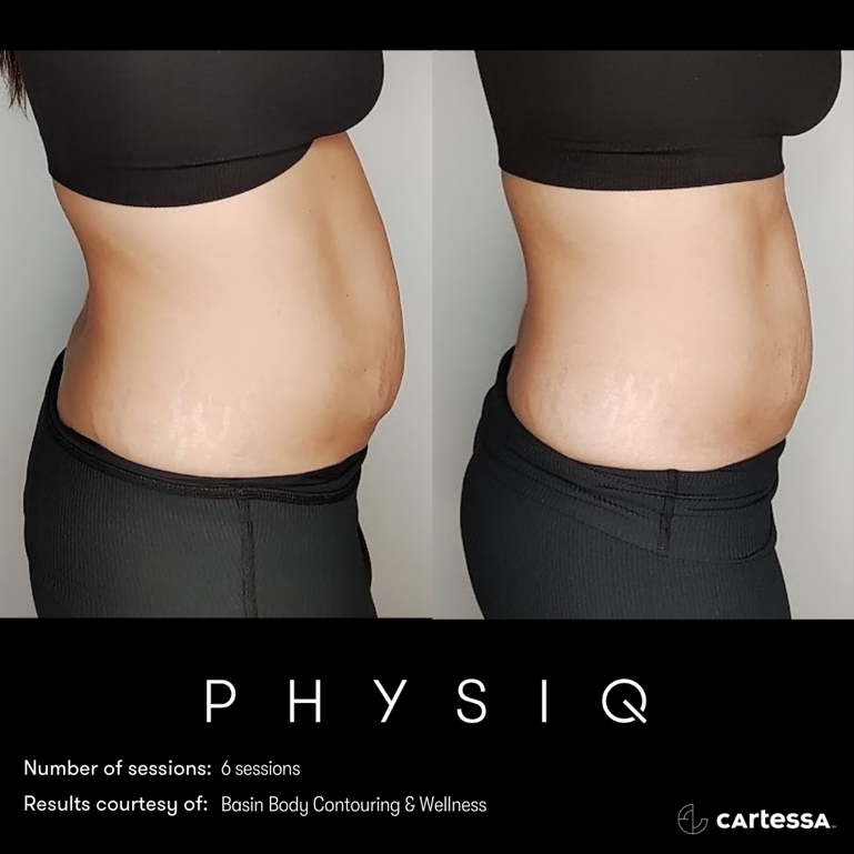PHYSIQ 360 - Men's Contemporary Health Center