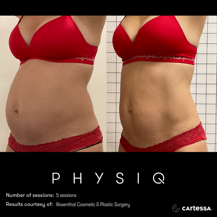 PHYSIQ 360 - Men's Contemporary Health Center