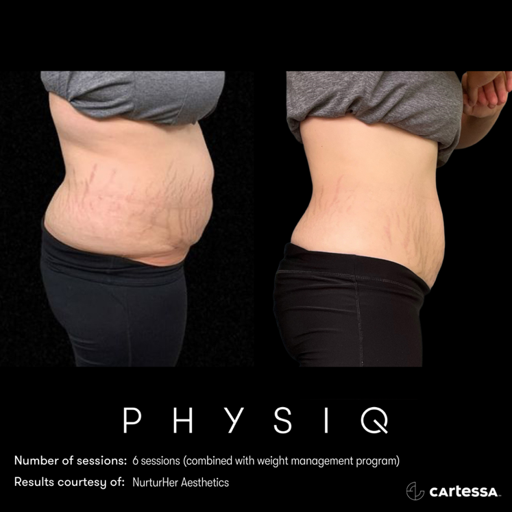 PHYSIQ 360 - Men's Contemporary Health Center