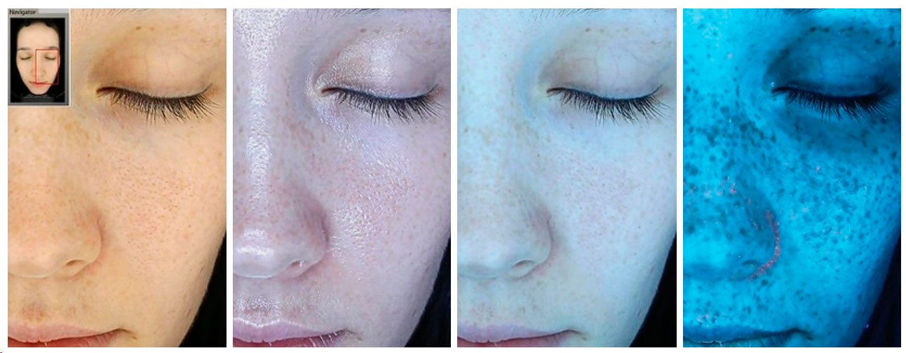 Glimpse In-depth Skin Analysis - Men's Contemporary Health Center